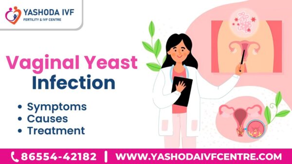 Vaginal Yeast Infection – Symptoms, causes and Treatment – Yashoda IVF ...