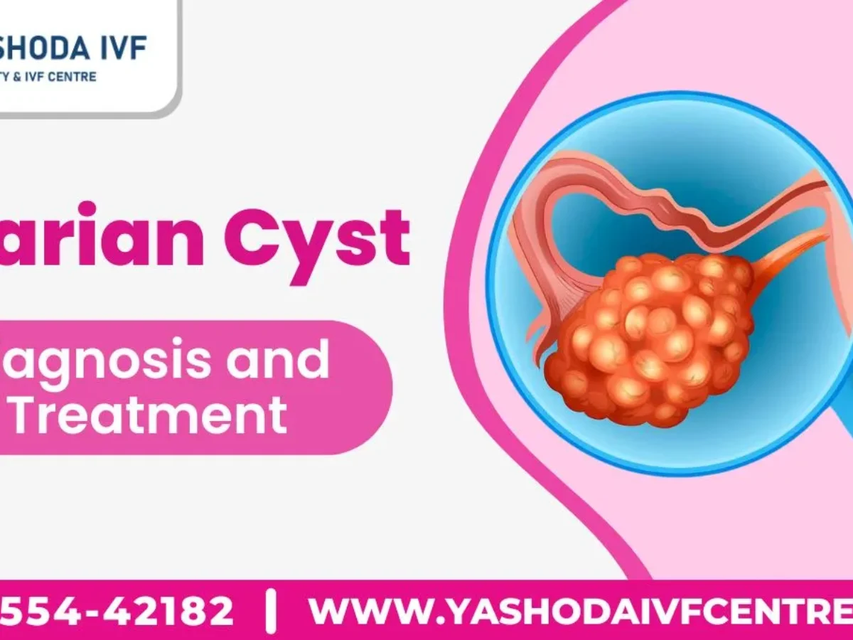 Ruptured Cyst Ovarian Cyst An Overview | ScienceDirect Topics